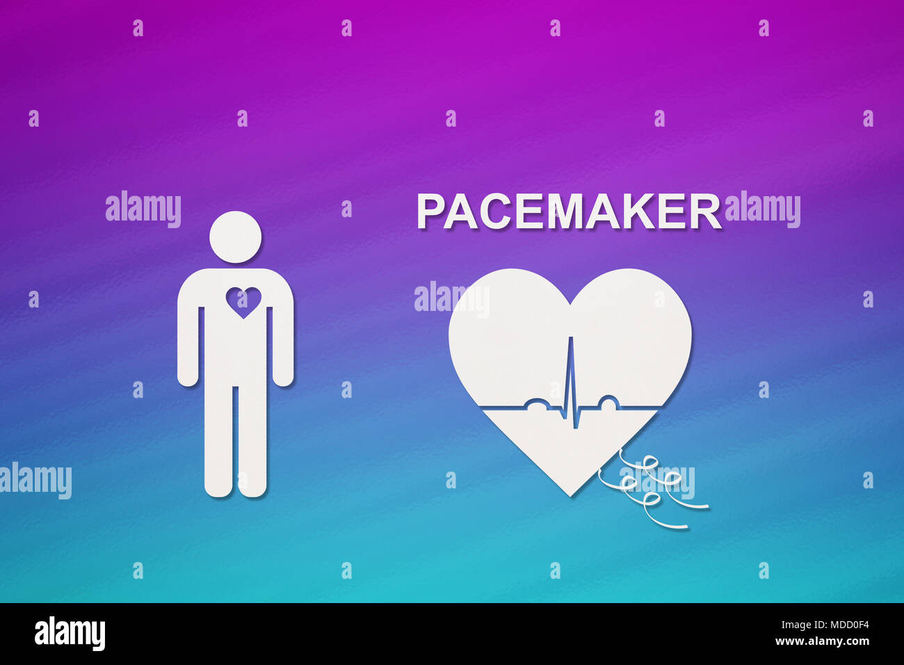 Man and heart shape with echocardiogram and PACEMAKER text. Medical ...