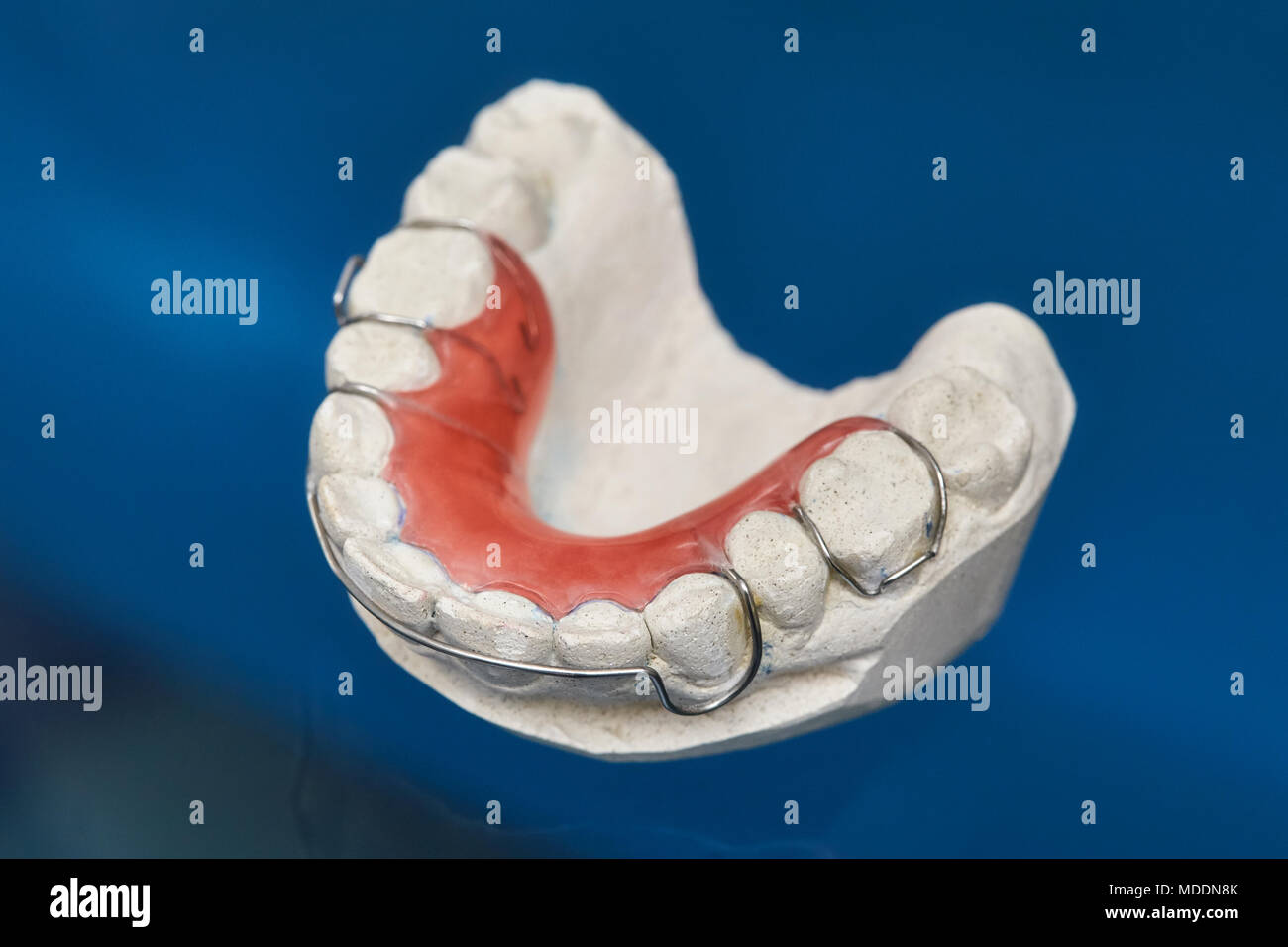 Colorful dental braces or retainers for teeth on black glass background ...