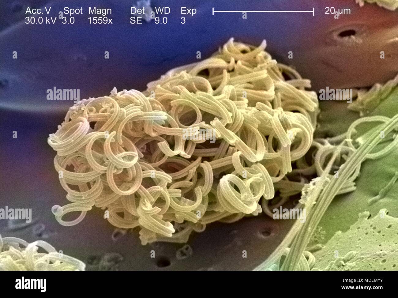 Microscopic debris attached to the exoskeletal surface of an ...