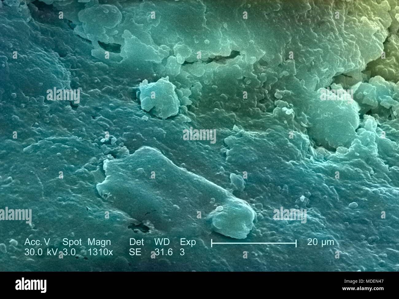 Cat Dander Electron Microscope