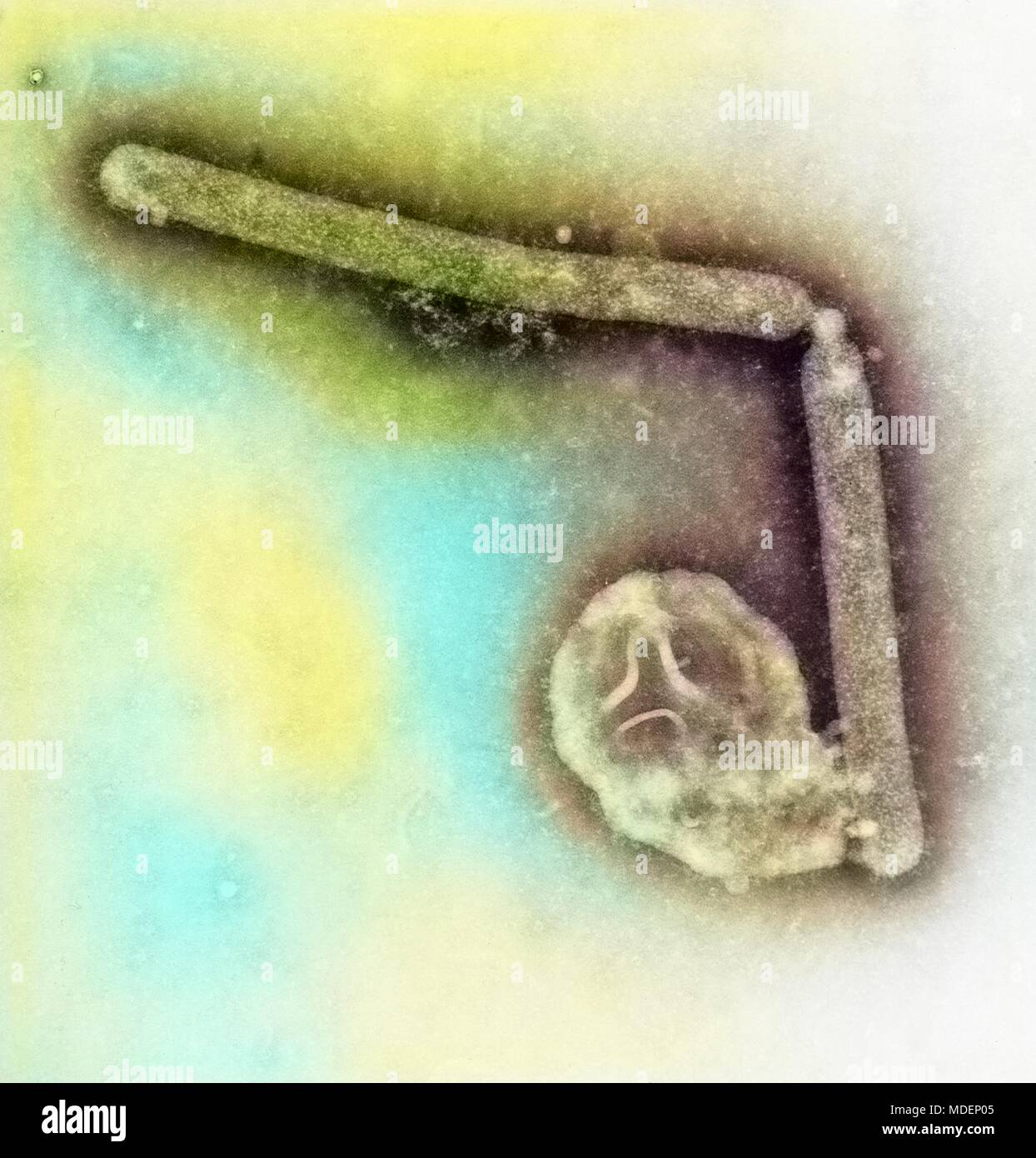Avian influenza sem hi-res stock photography and images - Alamy