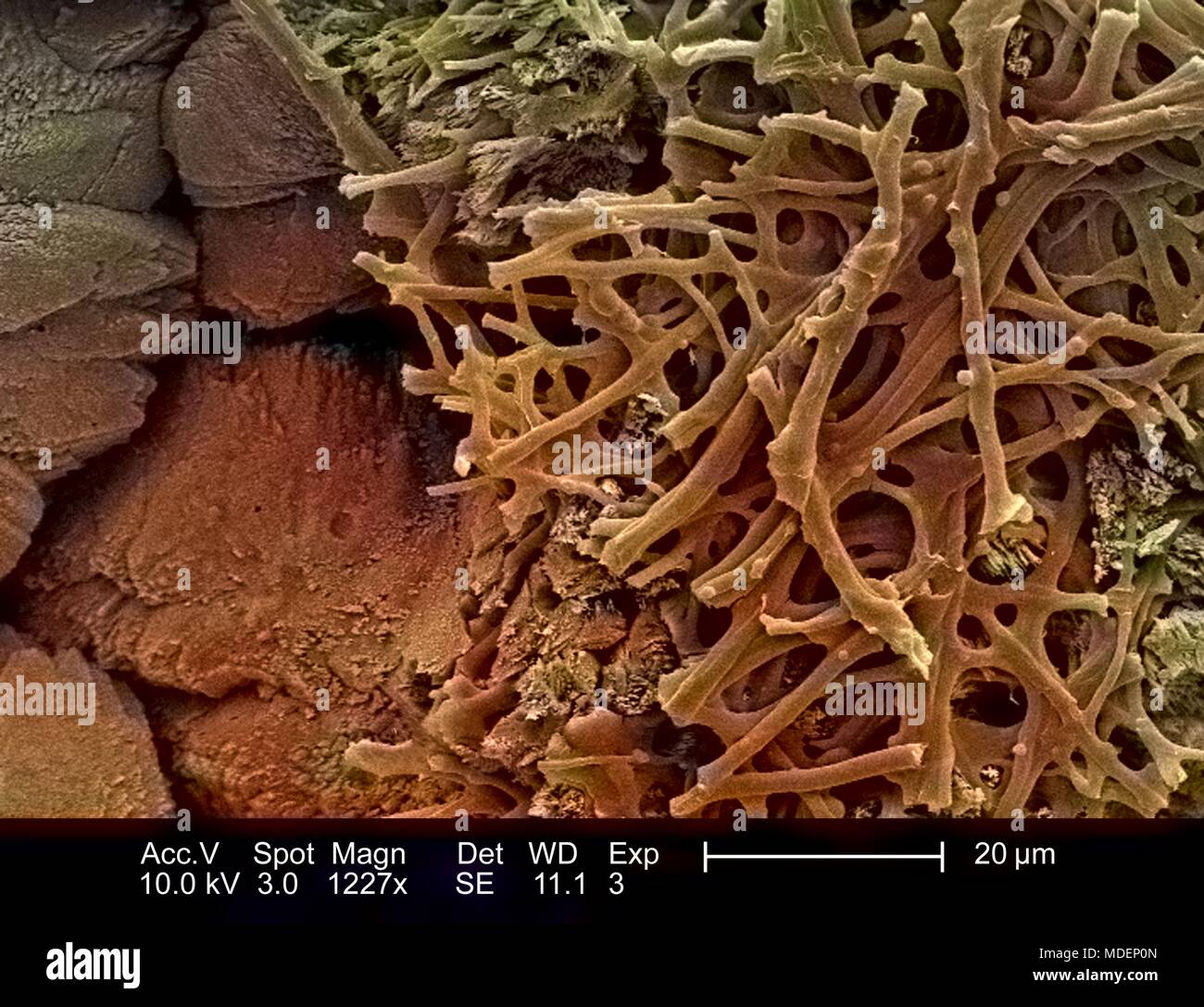 Morphologic characteristics of the inner surface of an unidentified ...
