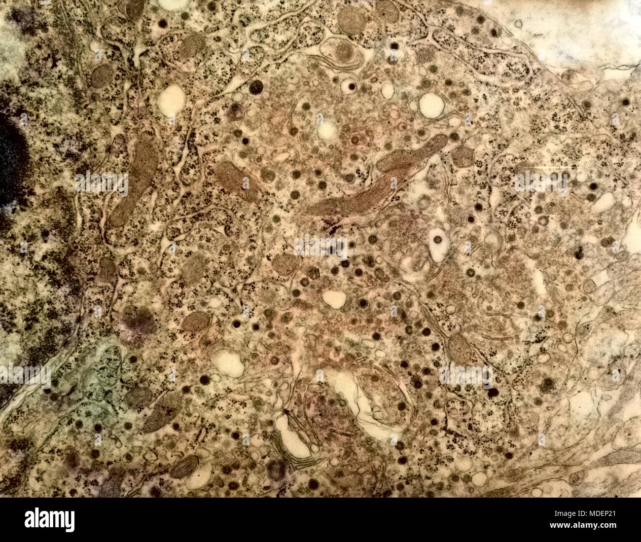 Tissue section infected with Rift Valley fever (RVF) virus revealed in ...