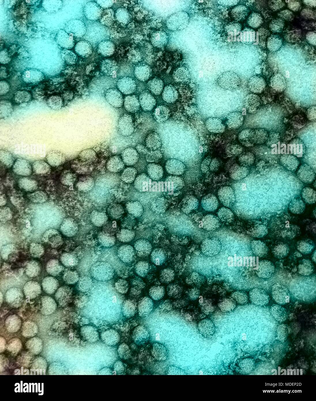 Transmission electron microscopy hi-res stock photography and images ...