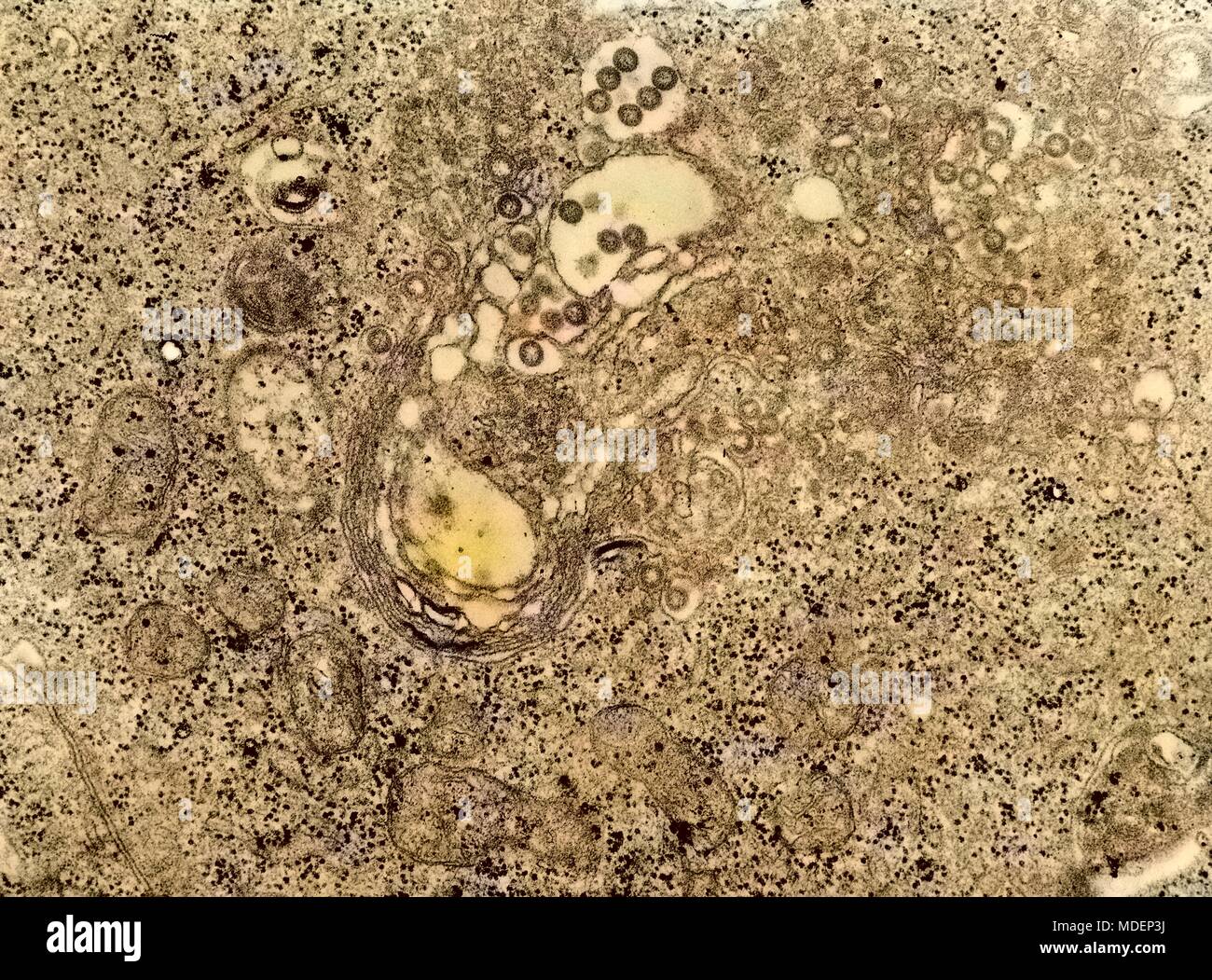 Tissue section infected with Rift Valley fever (RVF) virus revealed in ...