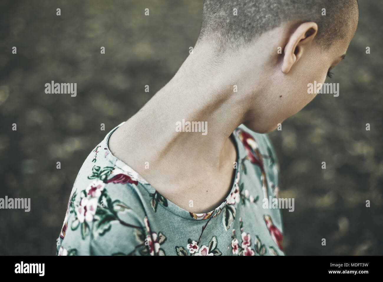 Cancer woman head hi-res stock photography and images - Alamy