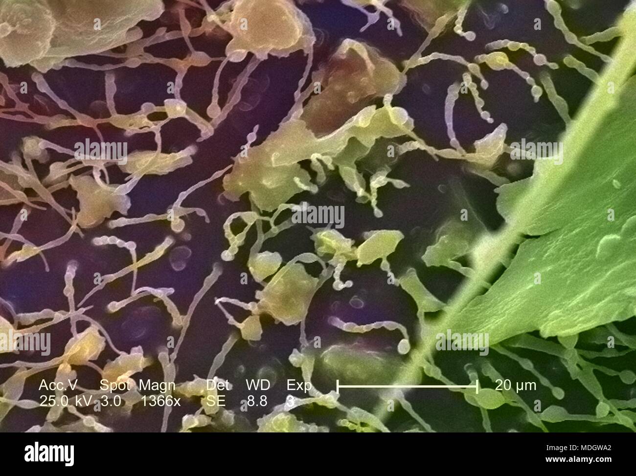 Sensorial hairs (setae) covering a dragonfly chitinous exoskeleton ...