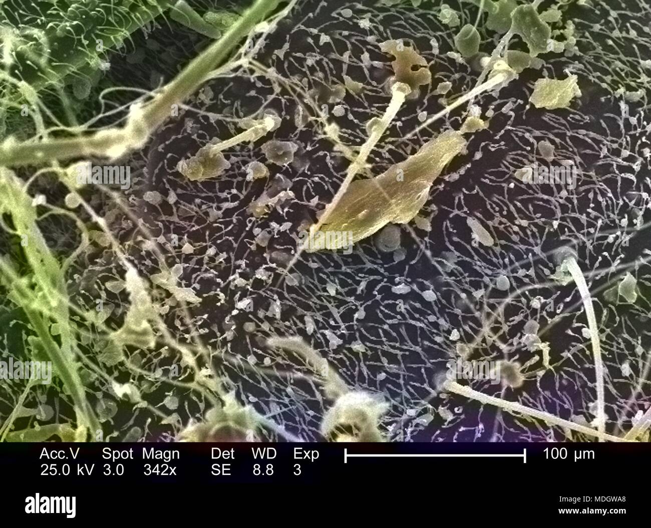 Sensorial hairs (setae) covering a dragonfly chitinous exoskeleton ...