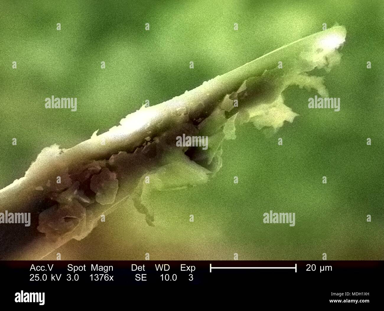 Ultrastructural morphologic details of an unidentified hymenopteran ...