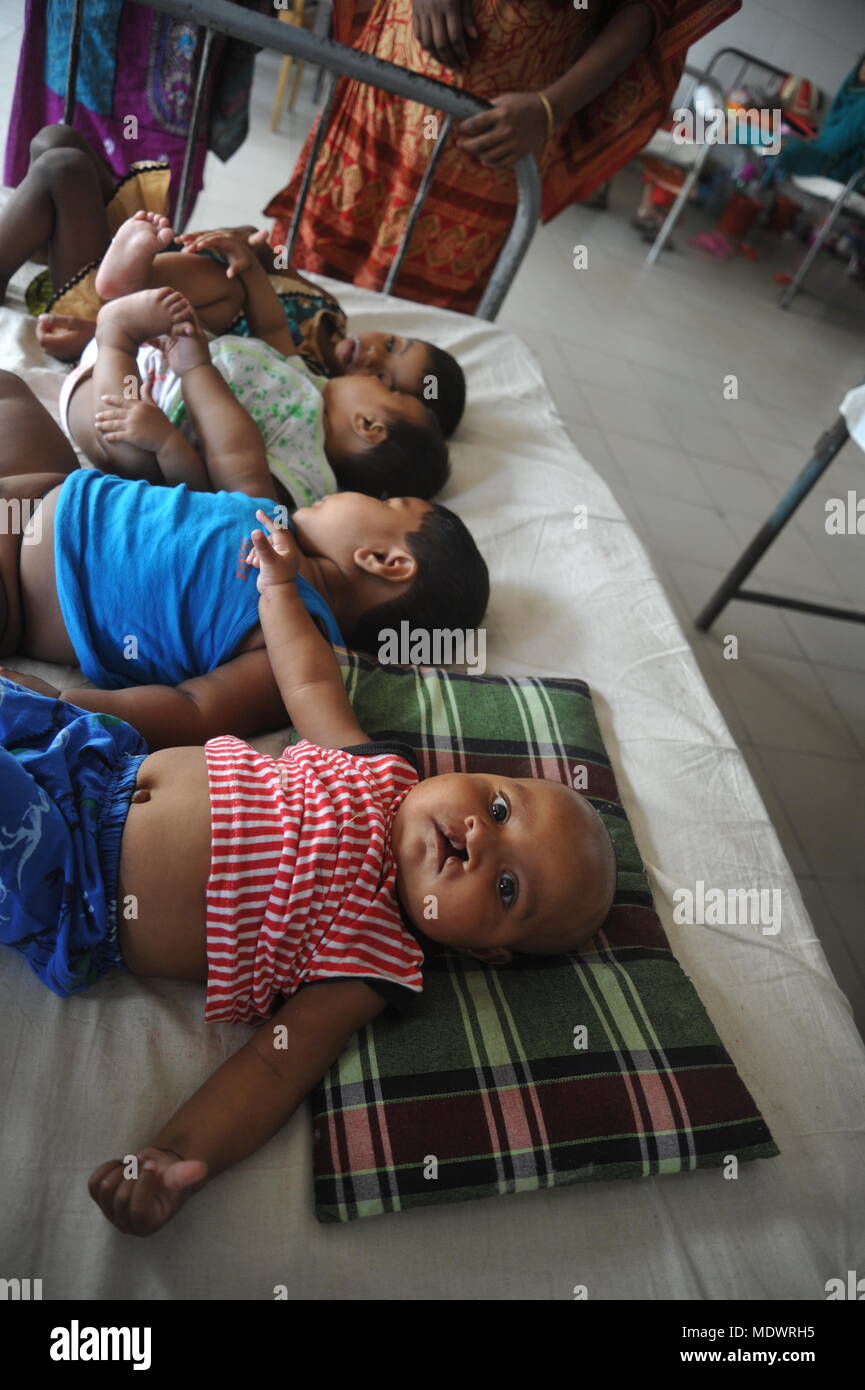 Birth defect baby boy with harelip in Dhaka medical college burn unit ...
