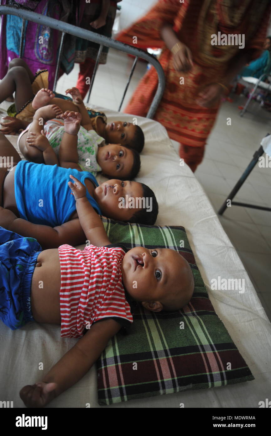 Birth defect baby boy with harelip in Dhaka medical college burn unit ...
