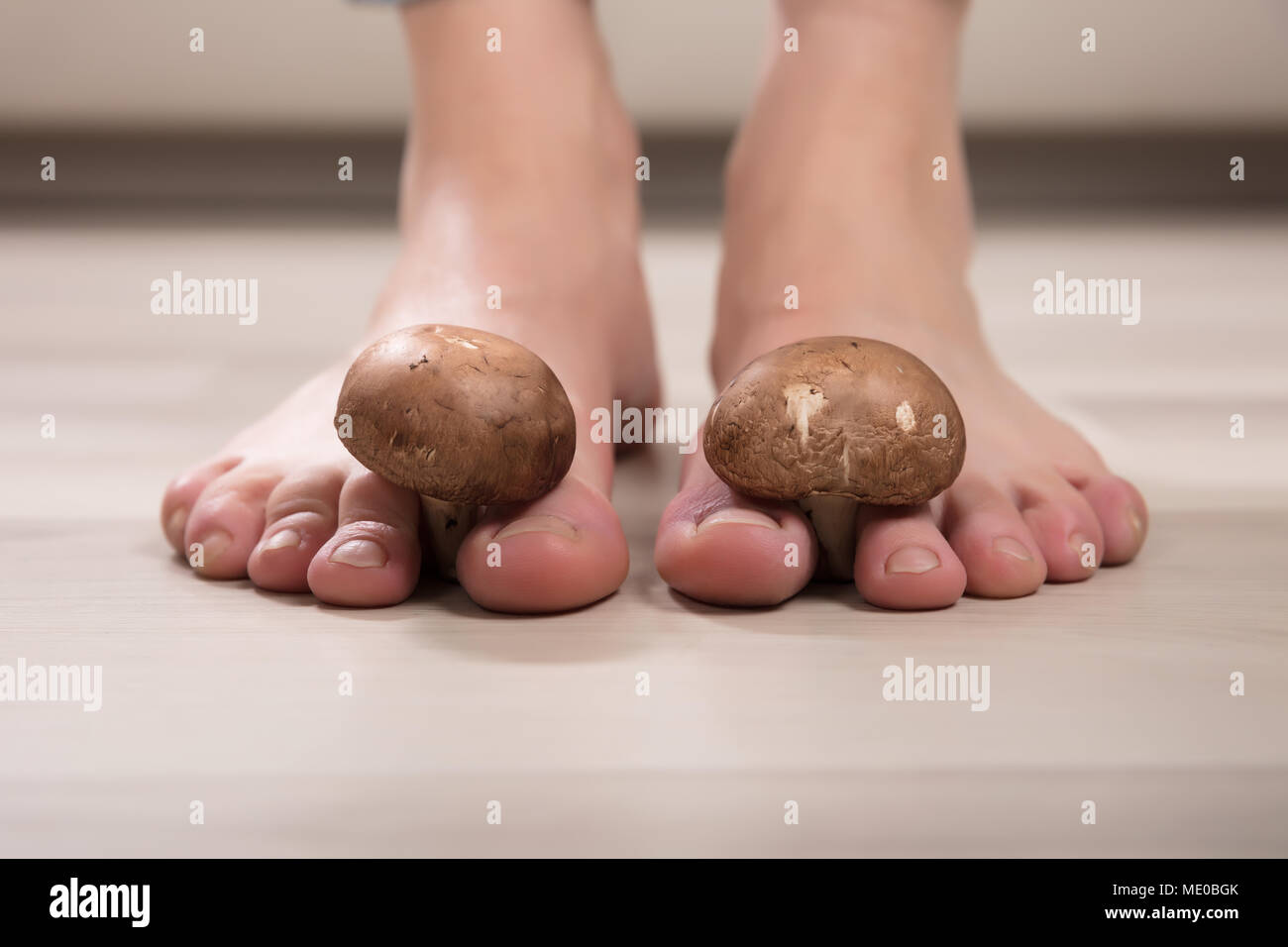 Close-up Of A Woman's Feet With Edible Mushrooms Between The Toes Stock ...