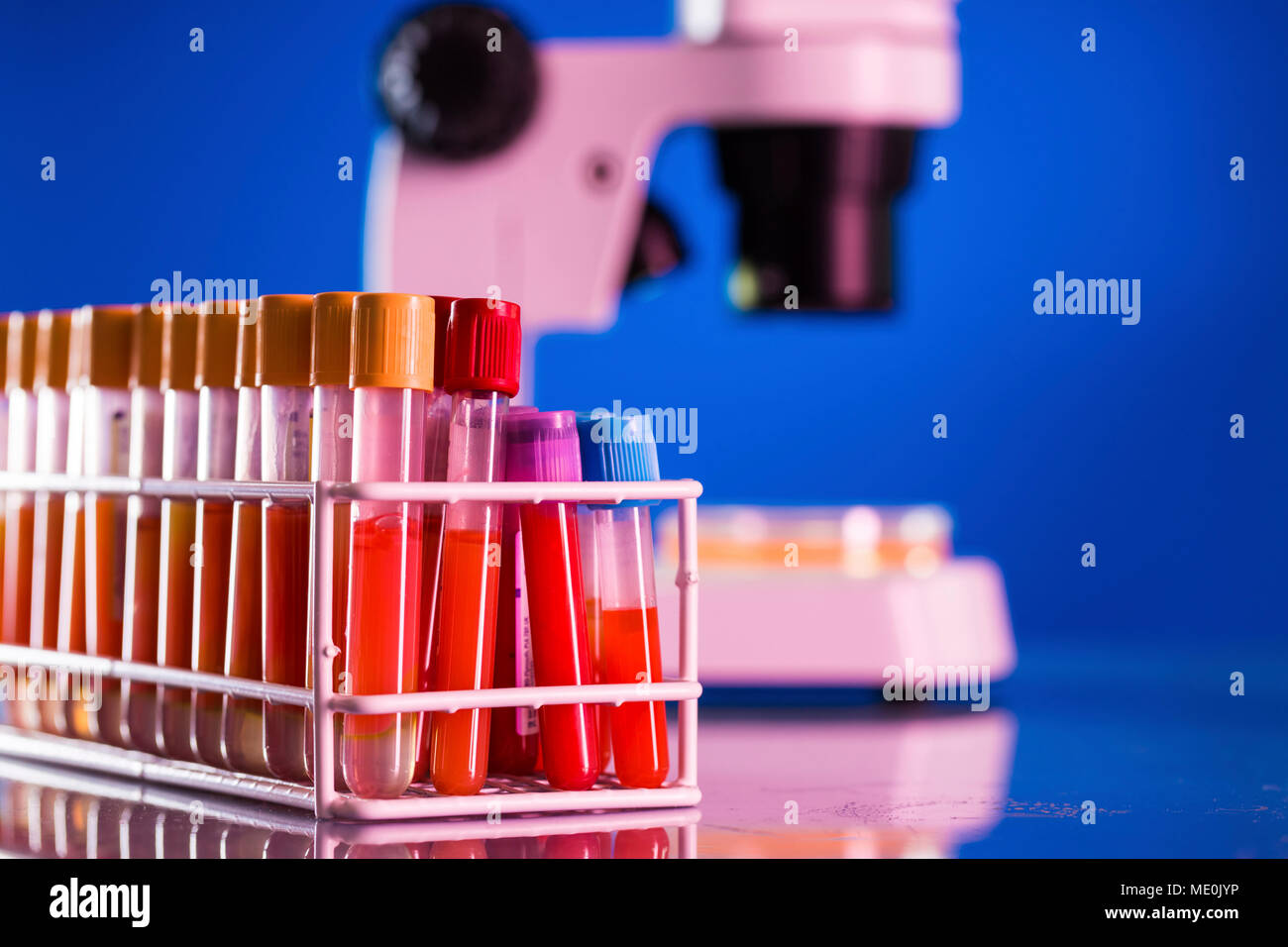 Blood test laboratory hi-res stock photography and images - Alamy