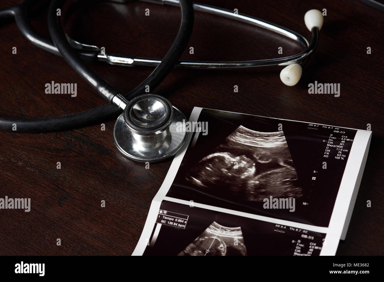 Unborn Child Scan Stock Photos & Unborn Child Scan Stock Images - Alamy