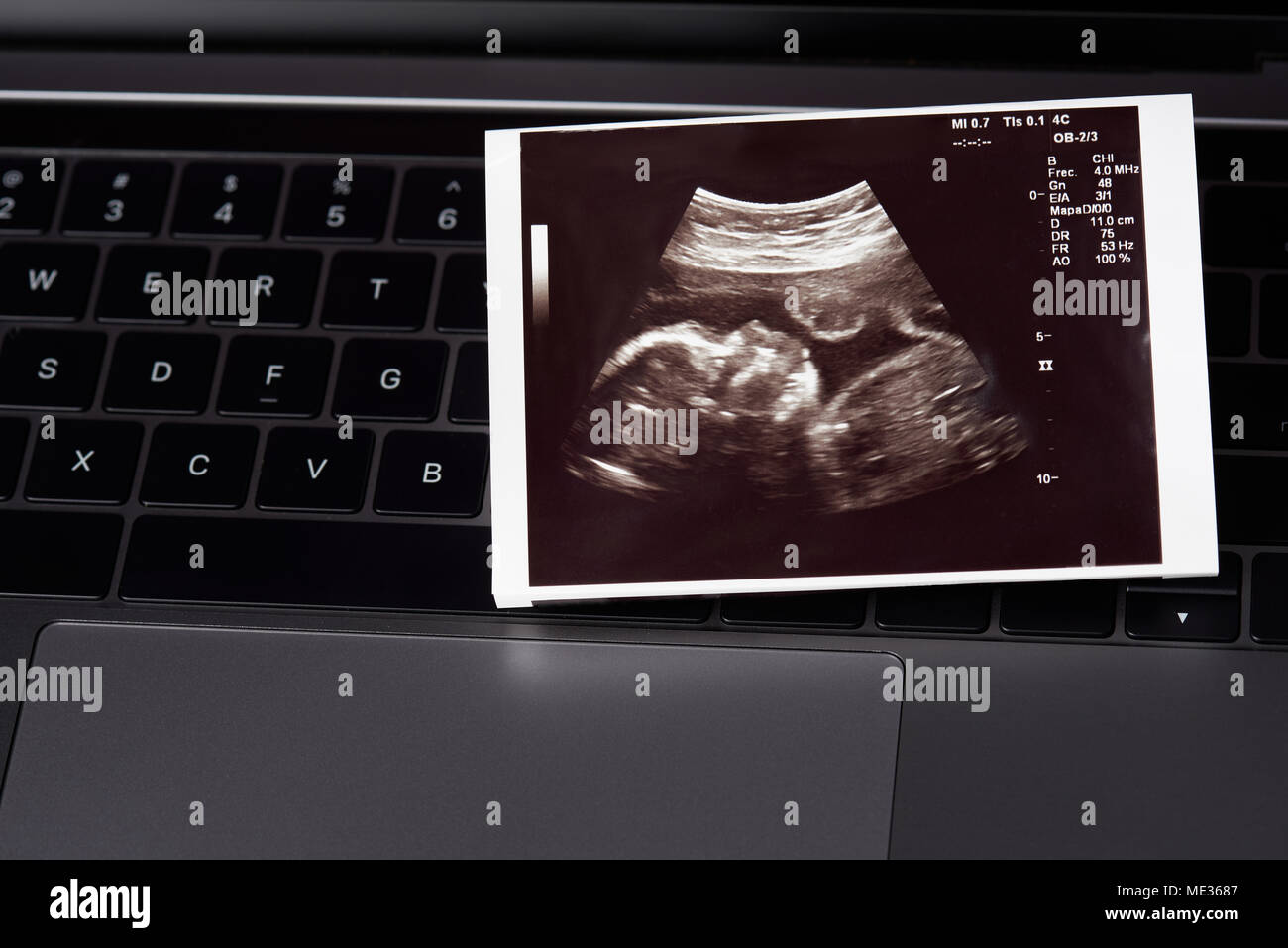 Ultrasound picture of baby lay on top of laptop keyboard Stock Photo ...