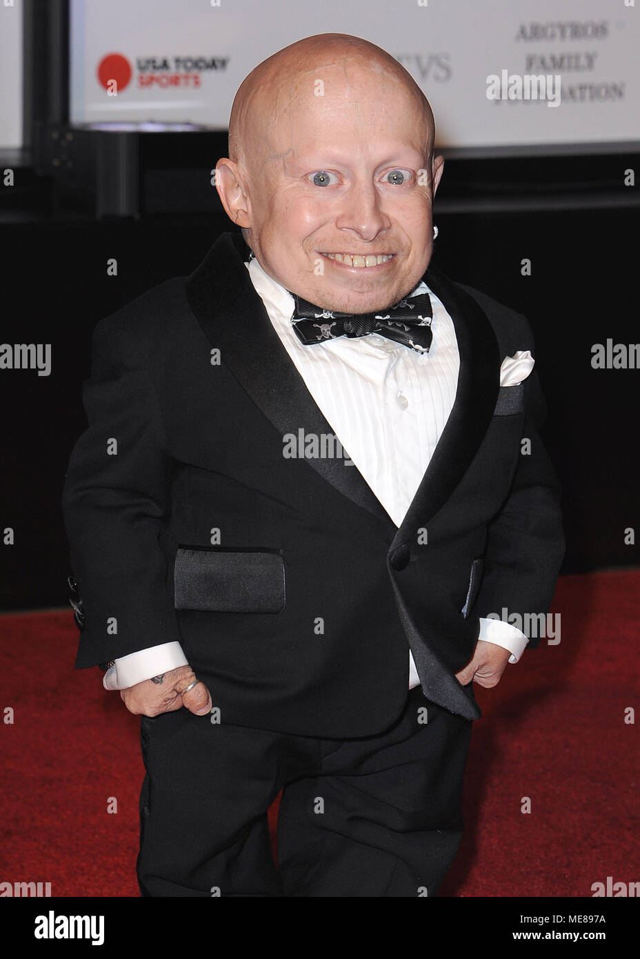 ***FILE PHOTO*** Verne Troyer Has Passed Away at Age 49 PHOENIX, AZ ...