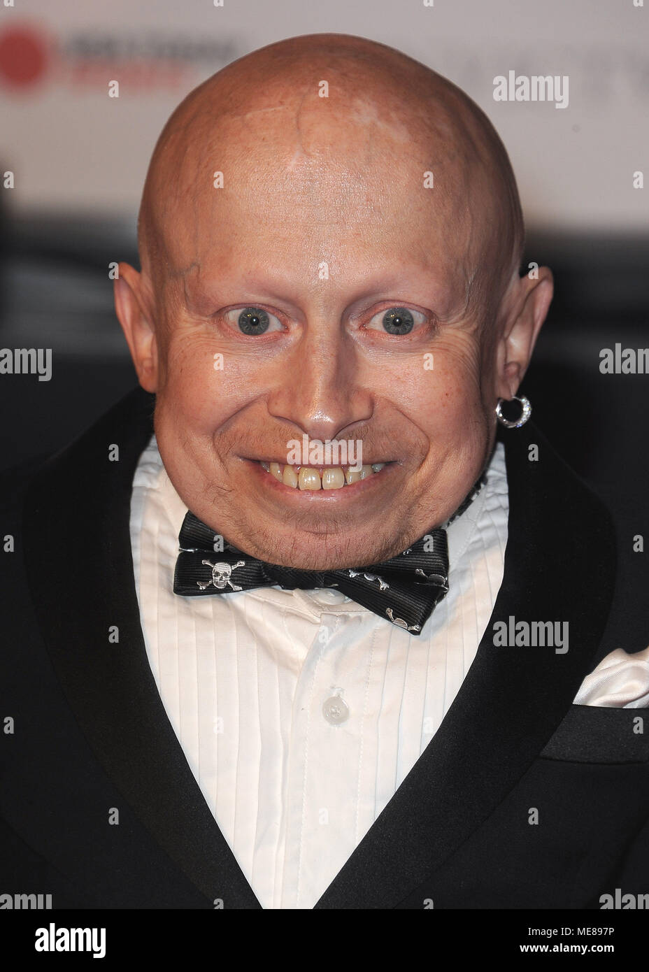 ***FILE PHOTO*** Verne Troyer Has Passed Away at Age 49 PHOENIX, AZ ...