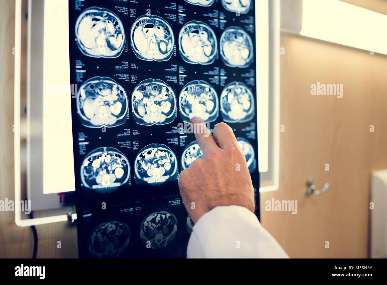 Brain ct scan hi-res stock photography and images - Alamy