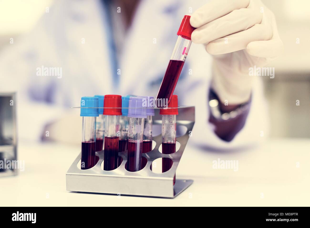 Doctor checking blood samples Stock Photo - Alamy