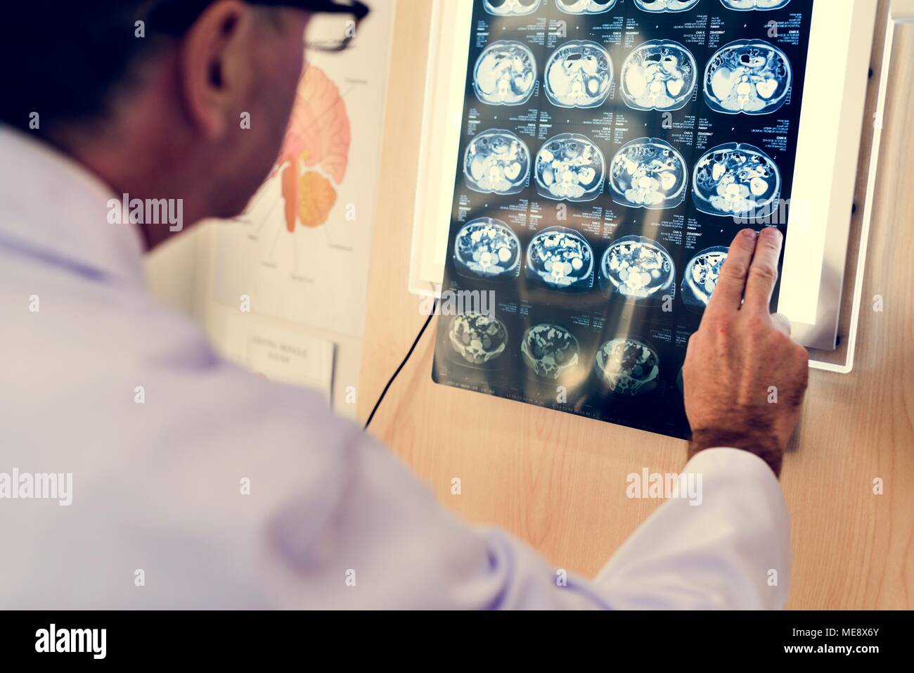 Doctor checking x-ray results Stock Photo - Alamy
