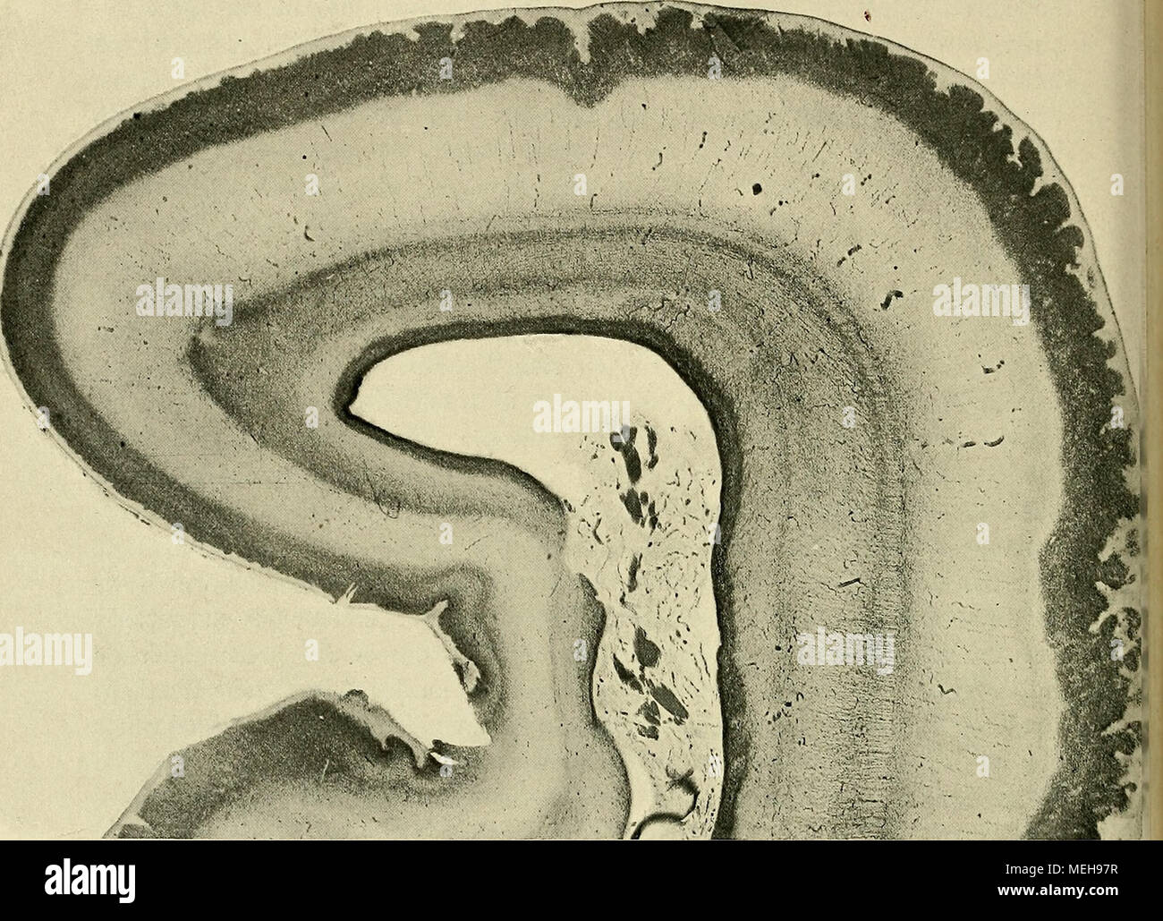 Occipitallappen hi-res stock photography and images - Alamy