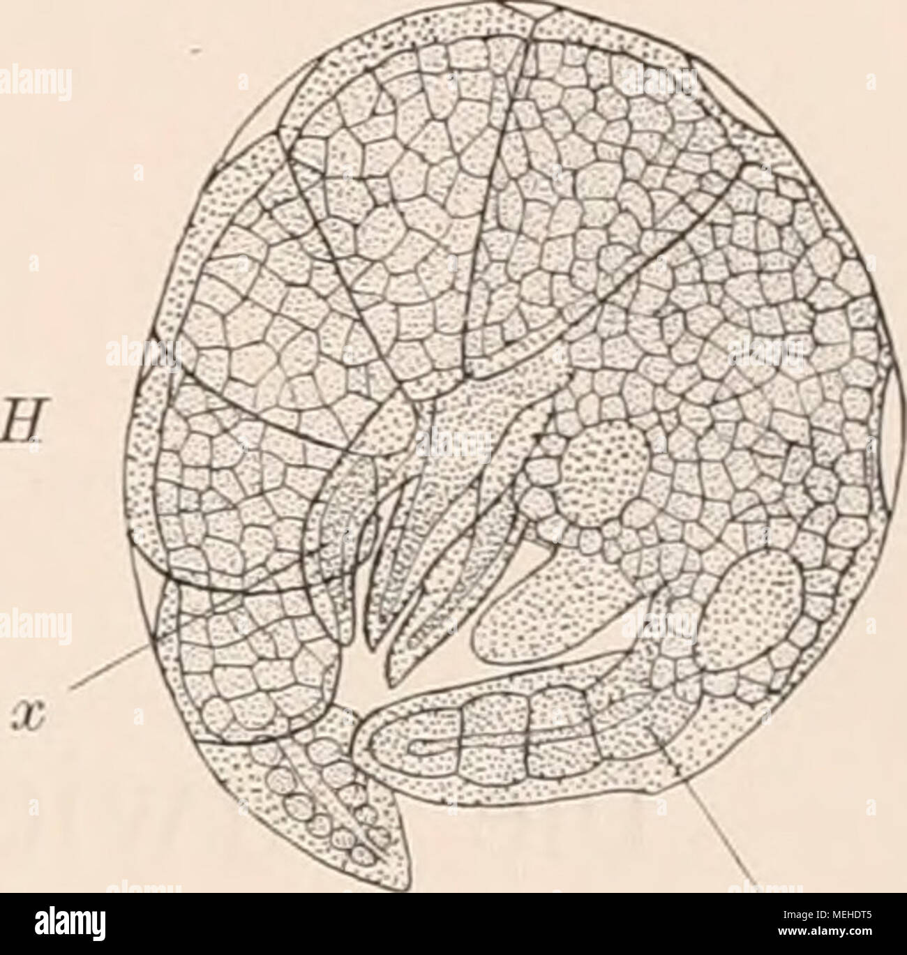 Enddarm hi-res stock photography and images - Alamy