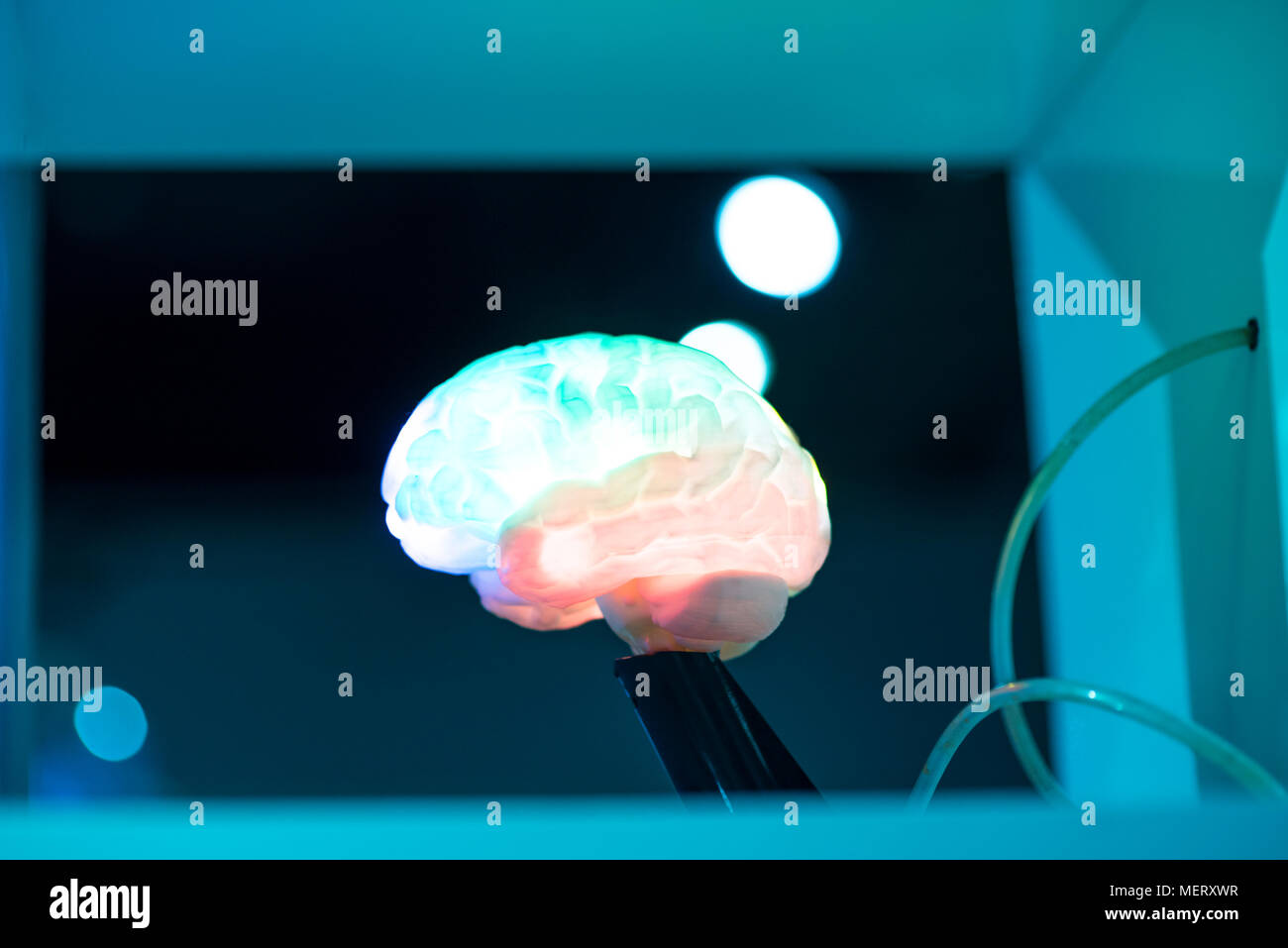 Mri brain scan on skull x ray hi-res stock photography and images - Alamy