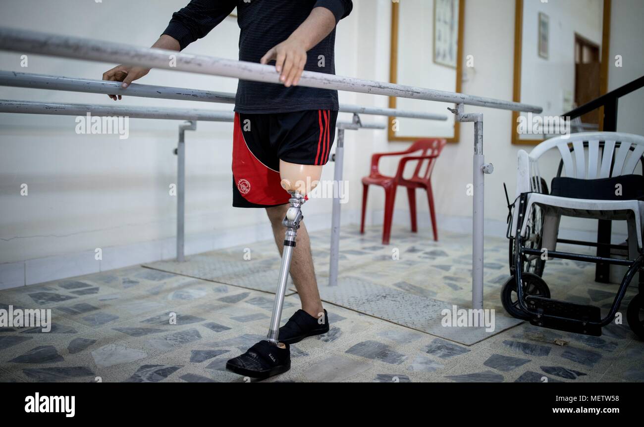 Limbs artifical hi-res stock photography and images - Alamy