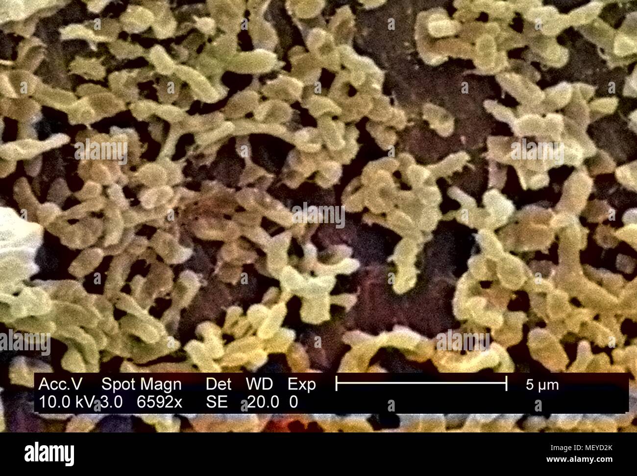 SEM micograph of a colony of P mirabilis (ATCC 29906), a Gram-Negative ...