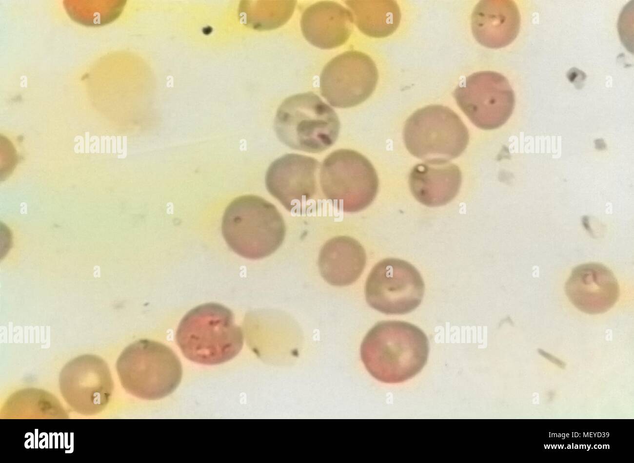 Babesia microti and Plasmodium berghei revealed in red blood cells ...