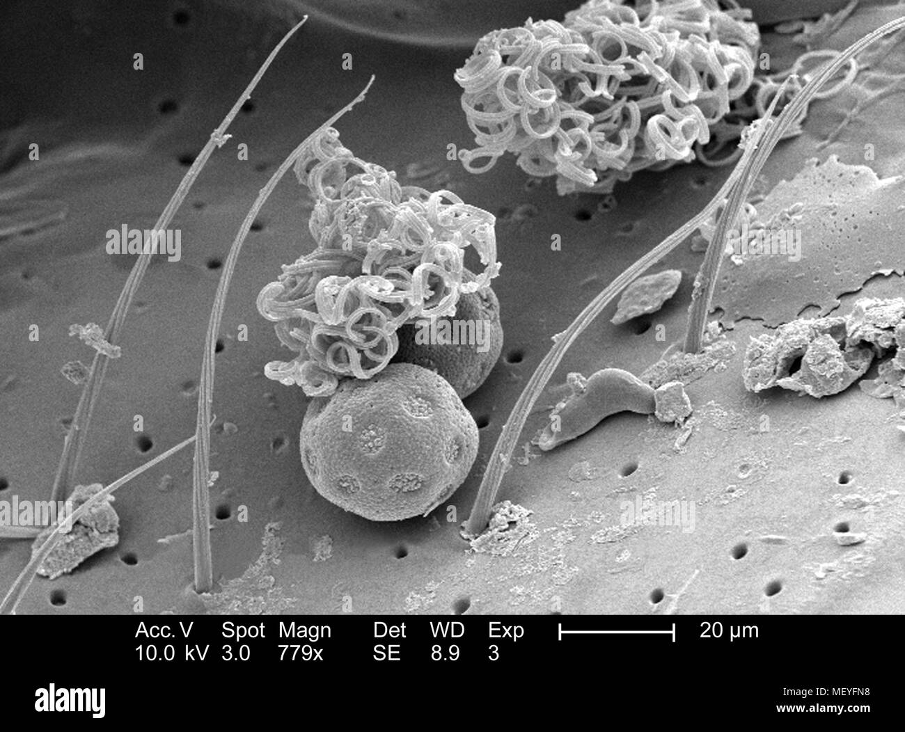 Microscopic debris attached to the exoskeletal surface of an ...