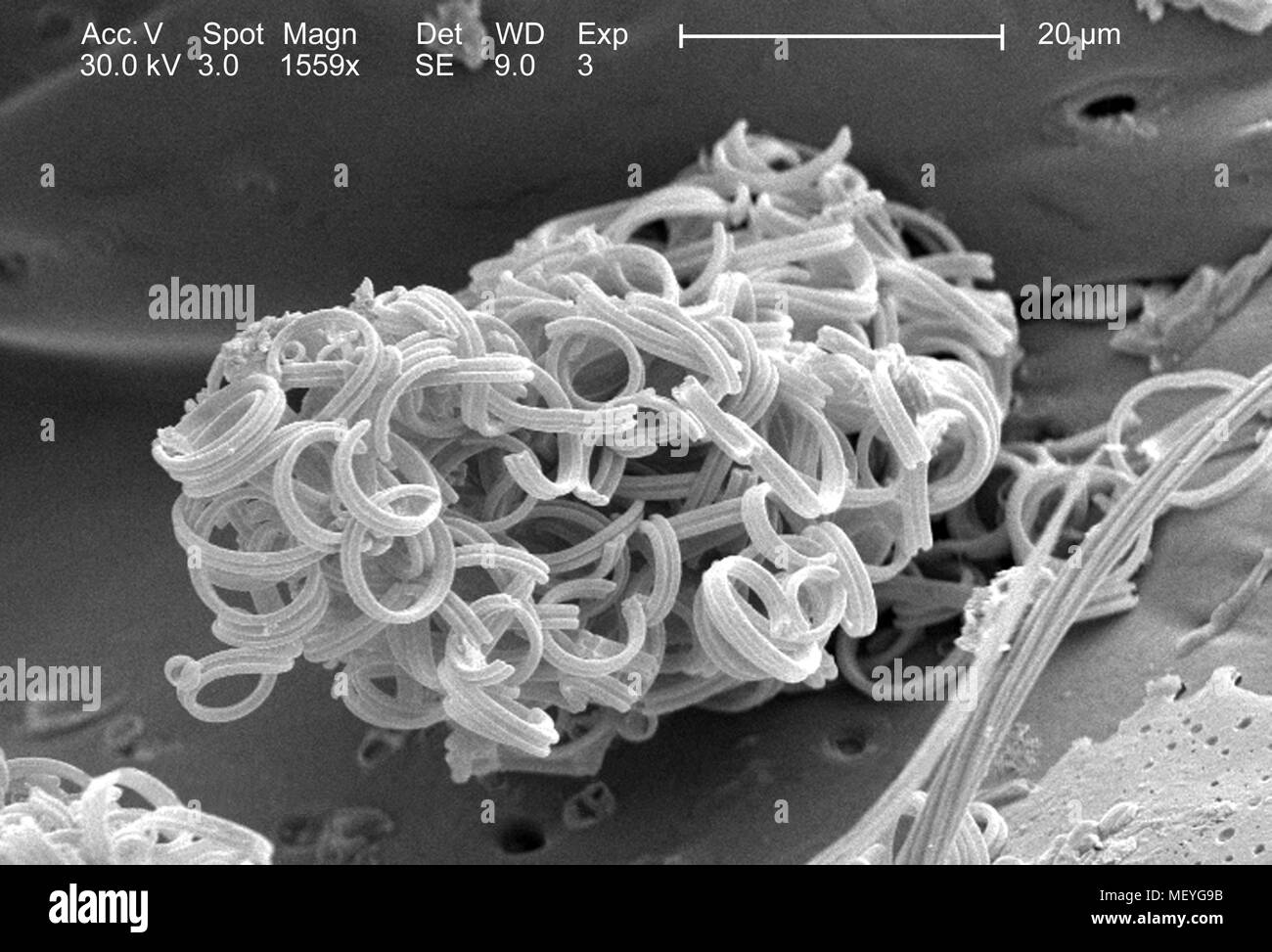 Microscopic debris attached to the exoskeletal surface of an ...