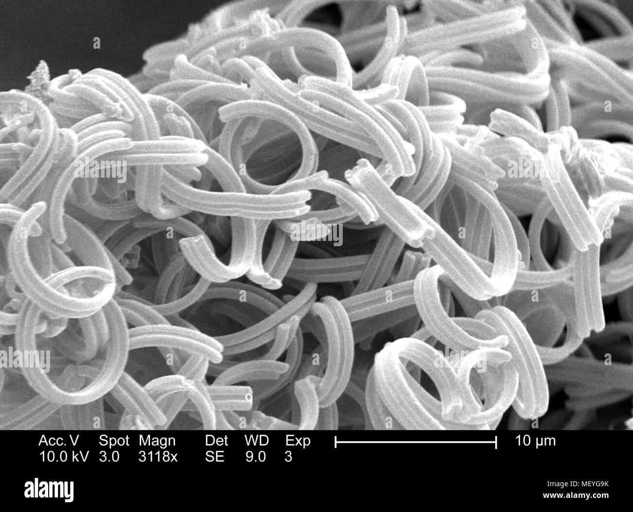 Microscopic debris attached to the exoskeletal surface of an ...