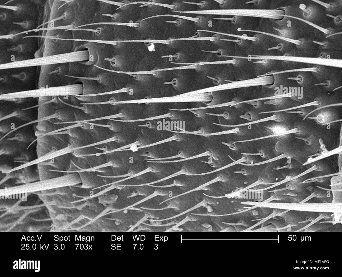 Ultrastructural details and sensorial hairs (Setae) of a dragonfly ...