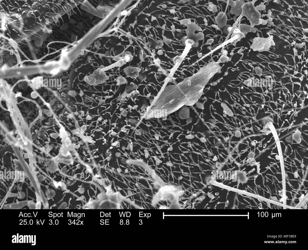 Dragonfly exoskeleton Black and White Stock Photos & Images - Alamy