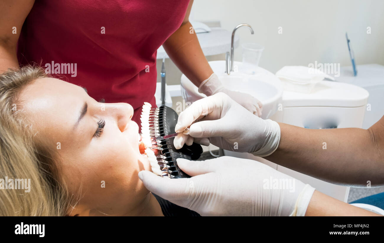 Closeup image of dentist checking patients teeth color tone with ...