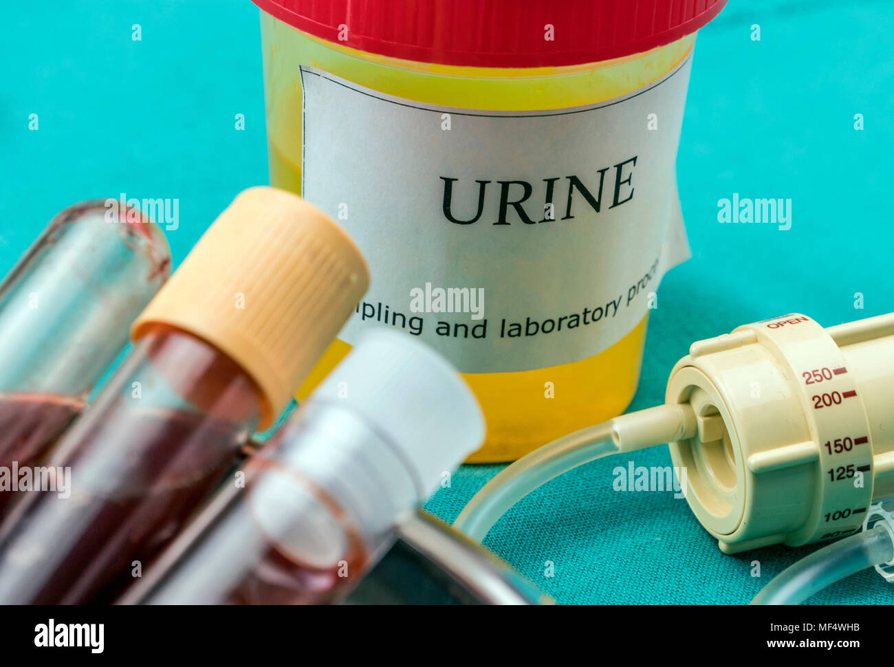 Urine and blood samples at a hospital table, conceptual image Stock ...