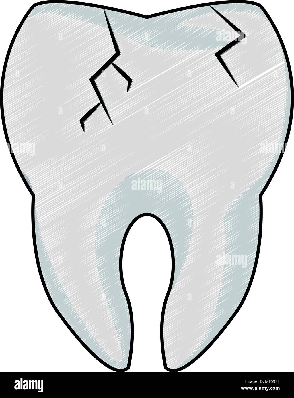 Tooth Decay Illustration Stock Photos & Tooth Decay Illustration Stock ...