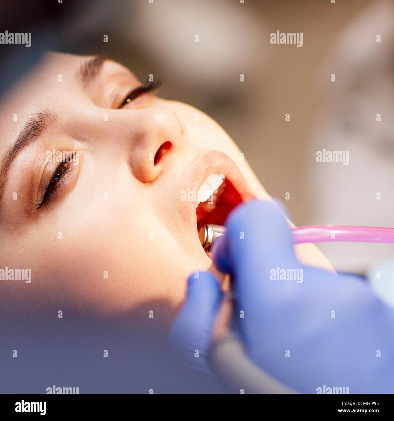 Male dentist treating teeth to young woman patient in clinic Stock ...