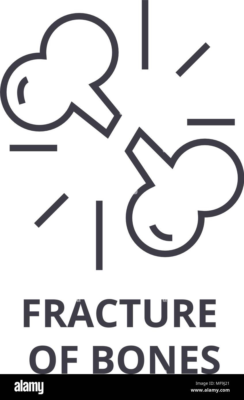 Brittle fracture hi-res stock photography and images - Alamy