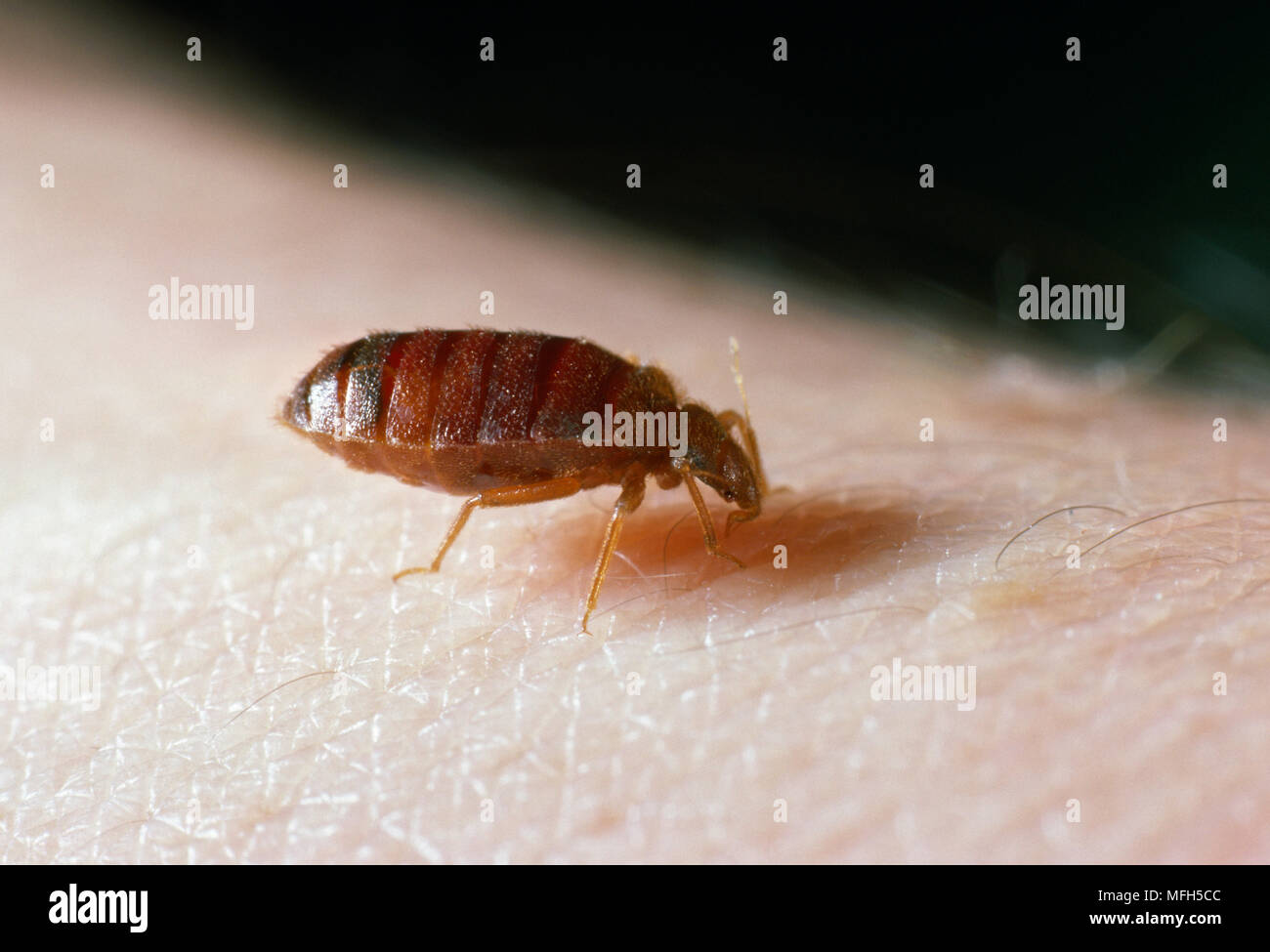 BEDBUG on human skin Cimex lectularius Stock Photo - Alamy