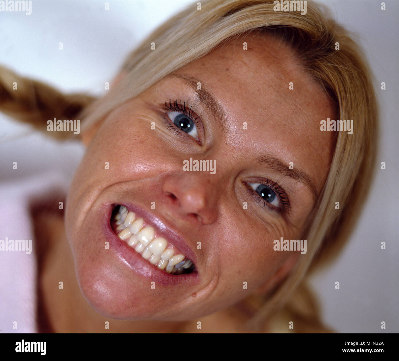 Close-up of a mid adult woman clenching her teeth Ref: CRB342 10021 057 ...