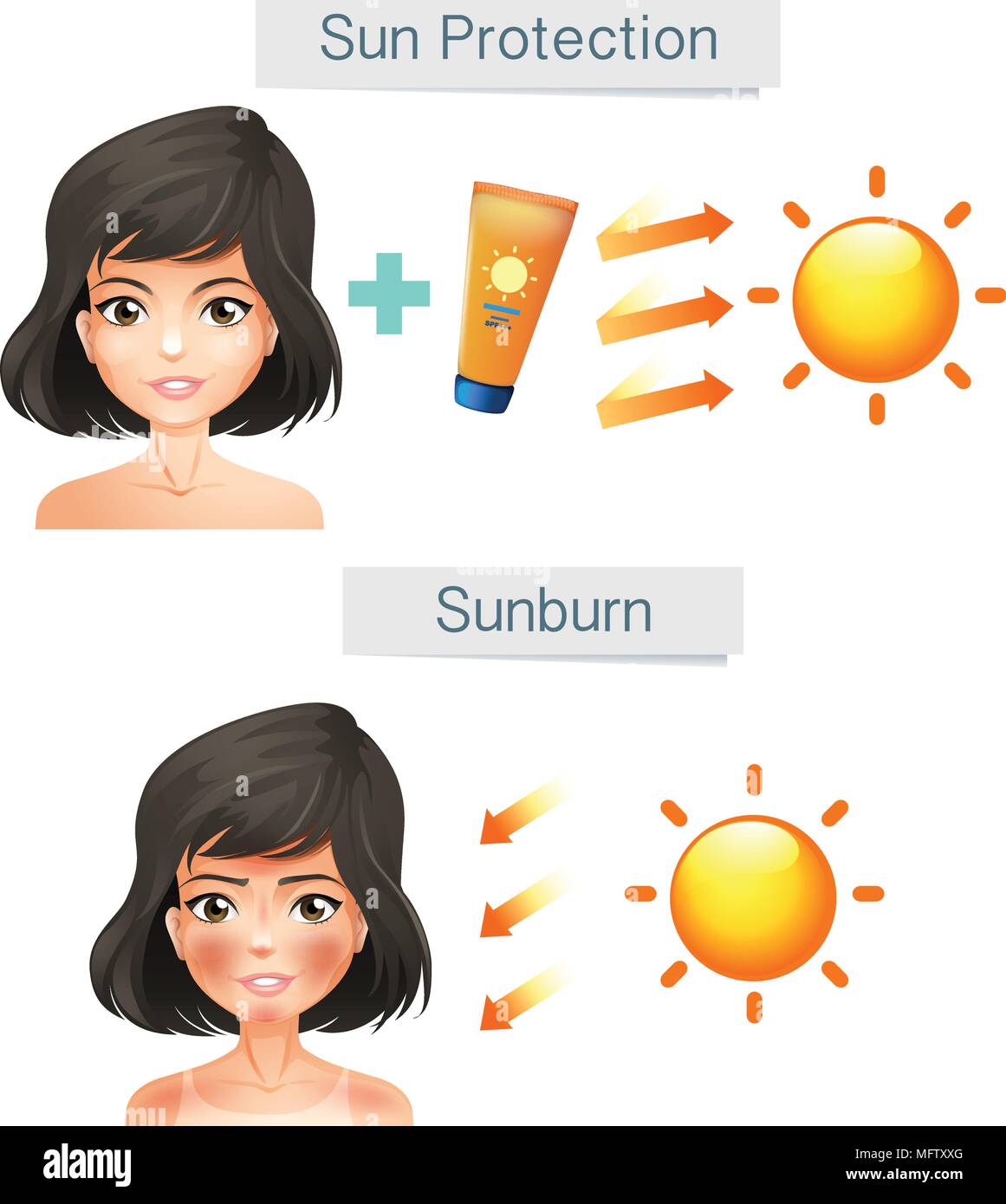 Vector Showing Women Skin After Sun illustration Stock Vector Image ...