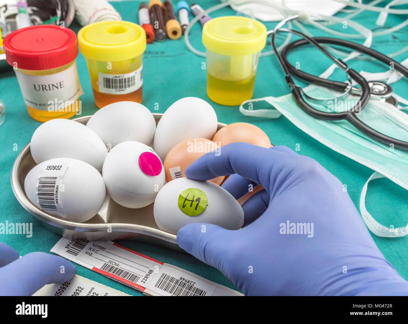 Scientific brand with label eggs in poor condition to examine in the ...