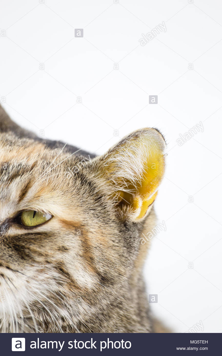 Ear Cancer Stock Photos & Ear Cancer Stock Images - Alamy