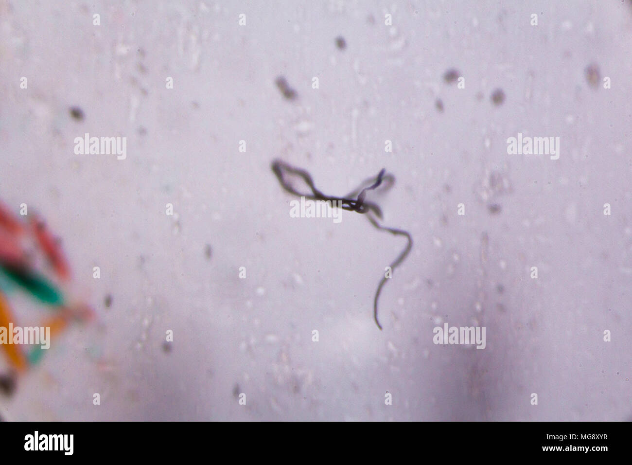 Bacteria under the microscope Stock Photo - Alamy