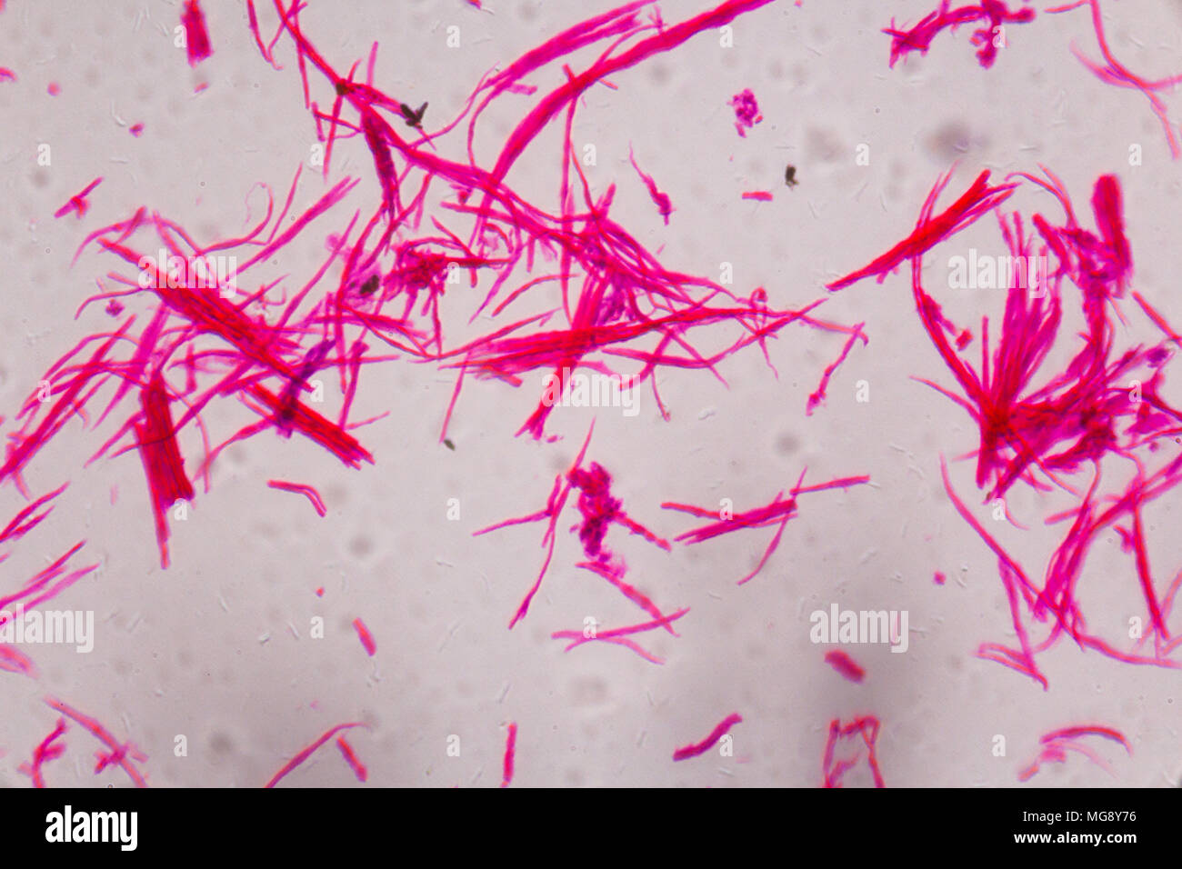 Smooth muscle separate under the microscope - Abstract pink lines on ...