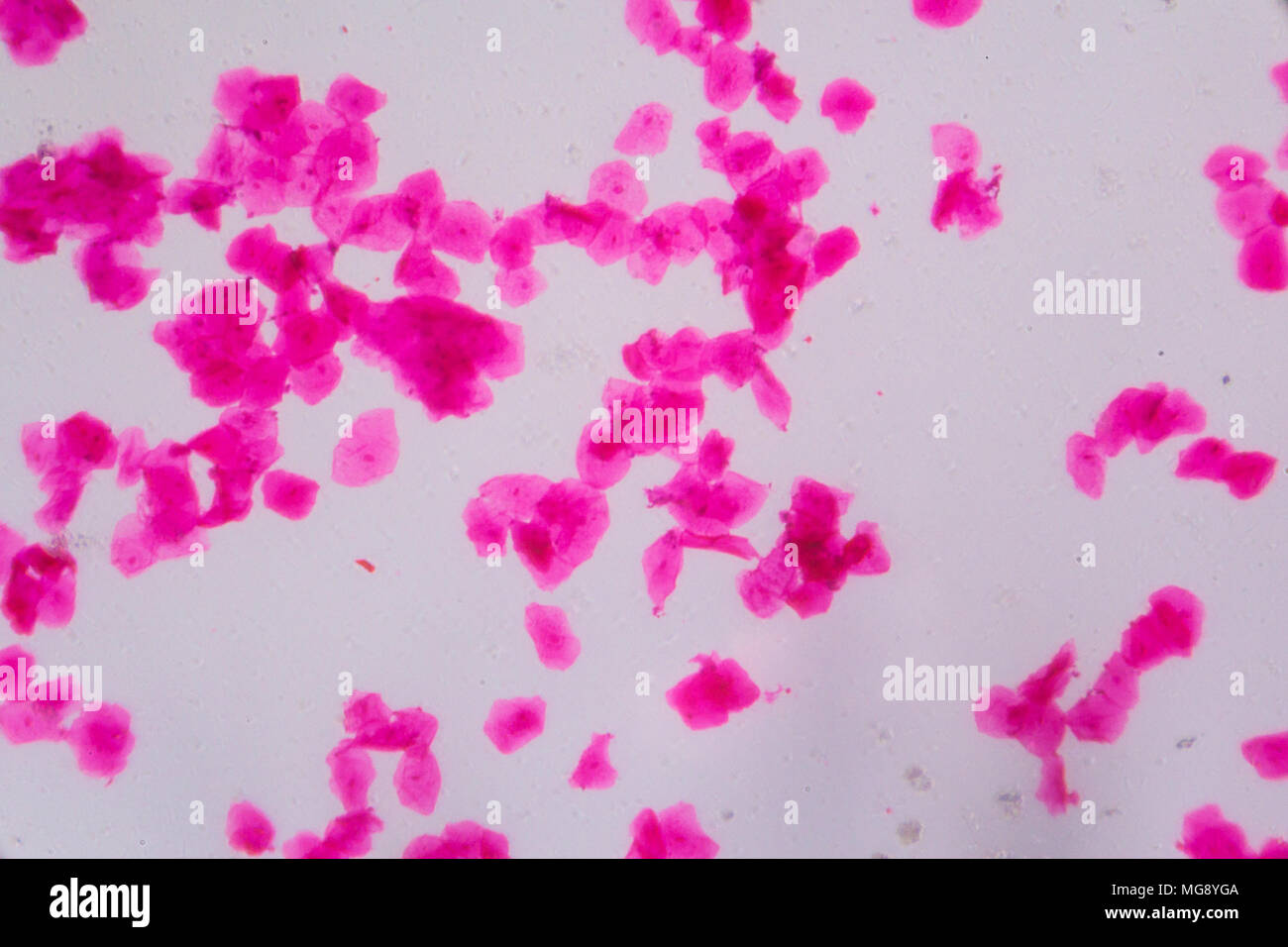 Multiple squamous epithelium under the microscope - Abstract pink dots ...
