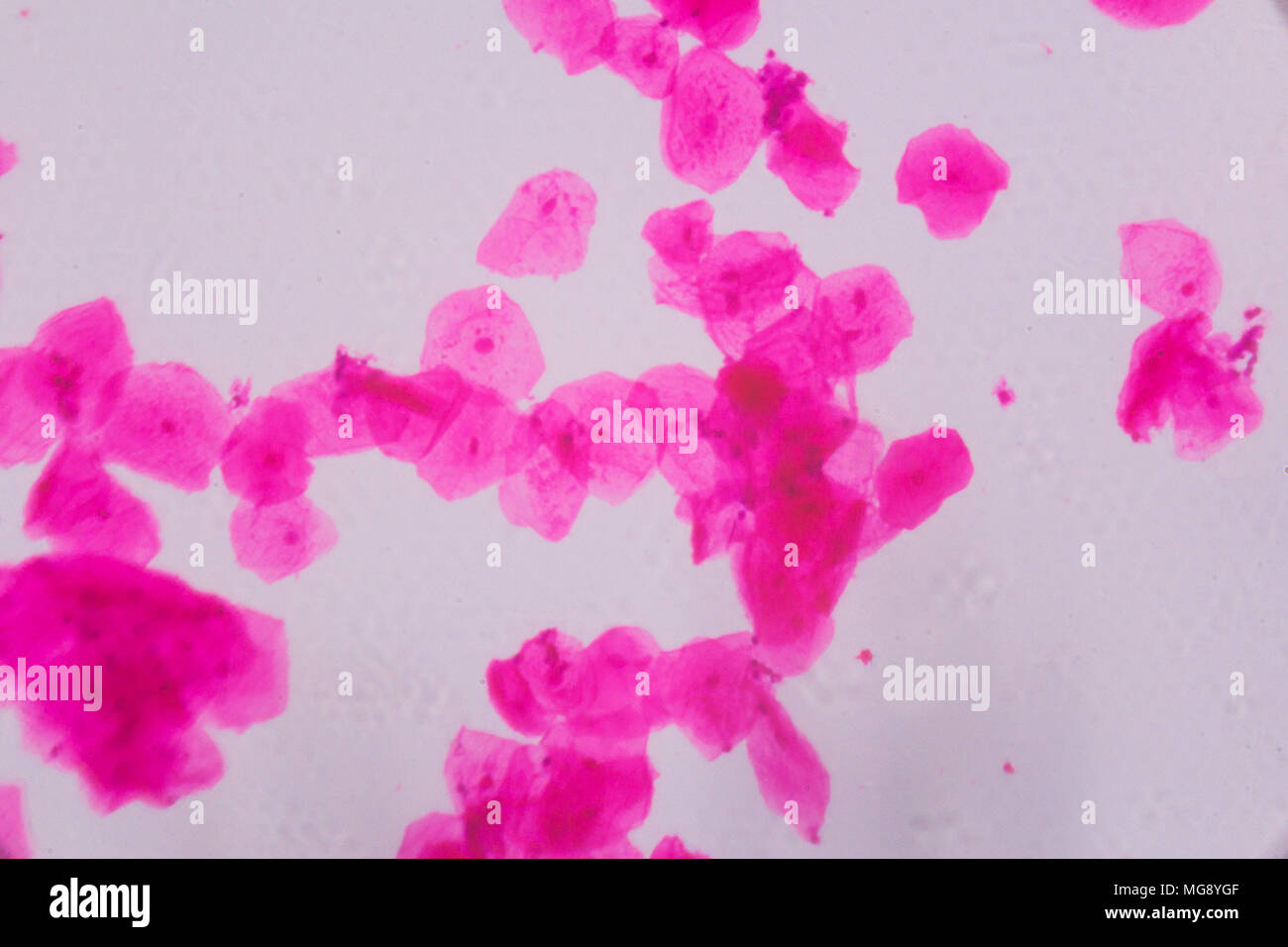 Multiple squamous epithelium under the microscope - Abstract pink dots ...