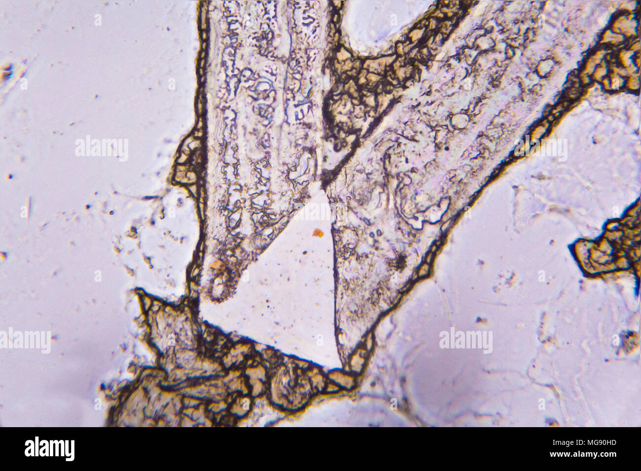 Congealed blood cells under the microscope Stock Photo - Alamy